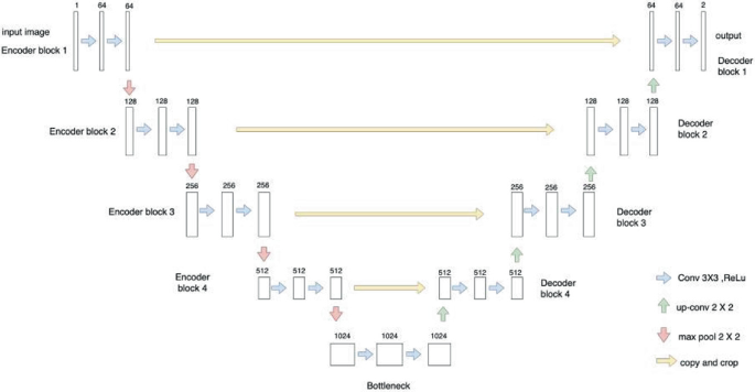 Detection of Brain Tumor Using U-Net Model Approach | SpringerLink