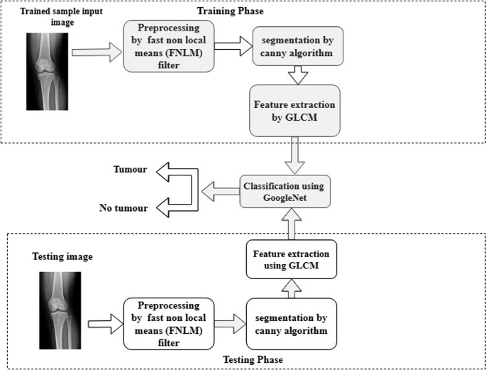Bone Tumor Detection and Classification Using GoogleNet Algorithm ...