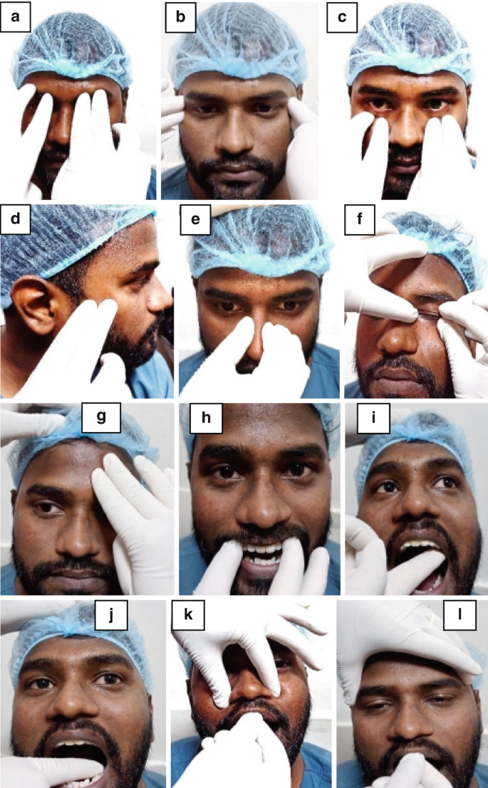 History and Examination of Maxillofacial Trauma | SpringerLink