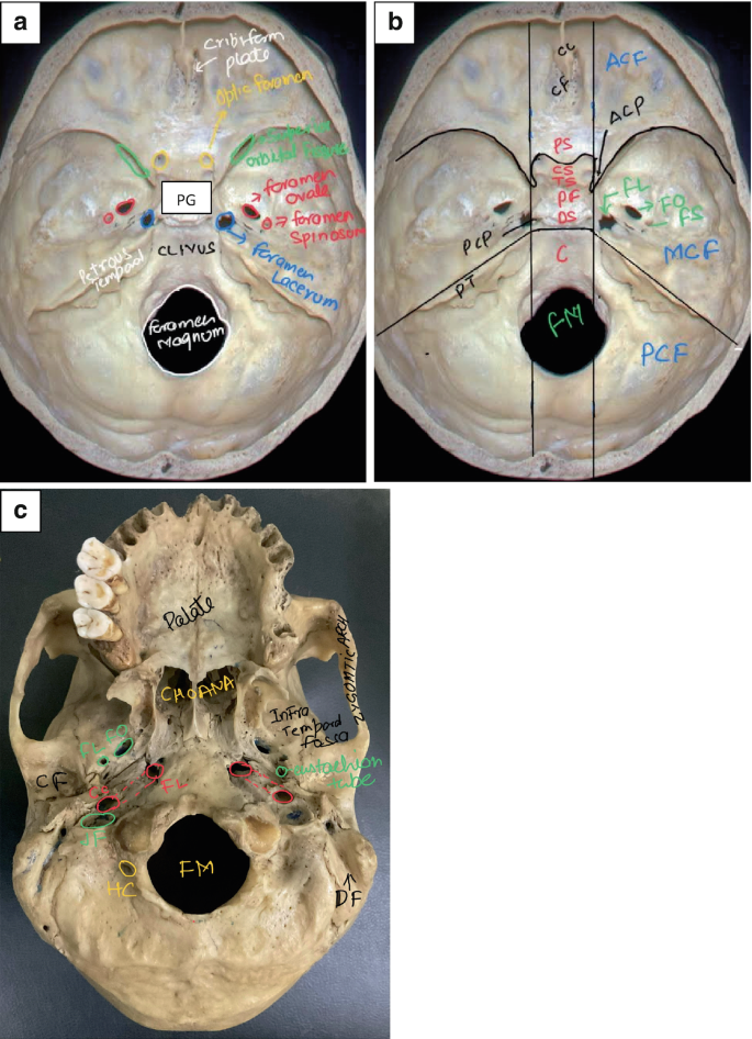 History and Examination of Skull Base | SpringerLink