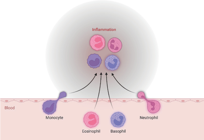 An Overview of Inflammatory Diseases | SpringerLink