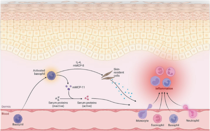 An Overview of Inflammatory Diseases | Springer Nature Link