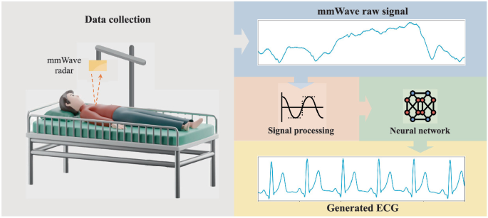 VibECG: Non-contact Electrocardiogram Monitoring Based on mmWave ...