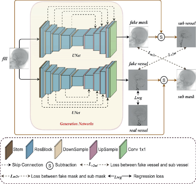 GDN: Generative Decoupling Network for Digital Subtraction Angiography ...