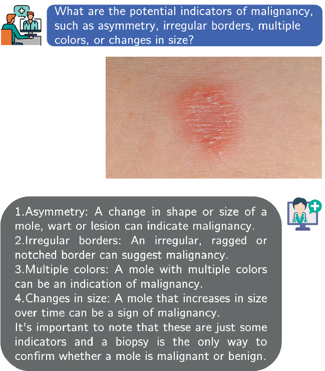 DermAI: A Chatbot Assistant for Skin Lesion Diagnosis Using Vision and ...