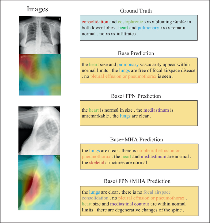 Radiology Report Generation Based on Multi-Scale Feature Fusion and ...