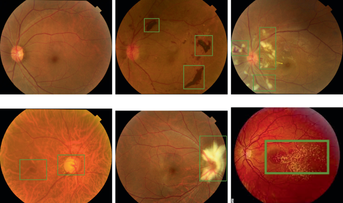 RetNet: A Two-Stage Deep Neural Network for Clinically Traceable ...