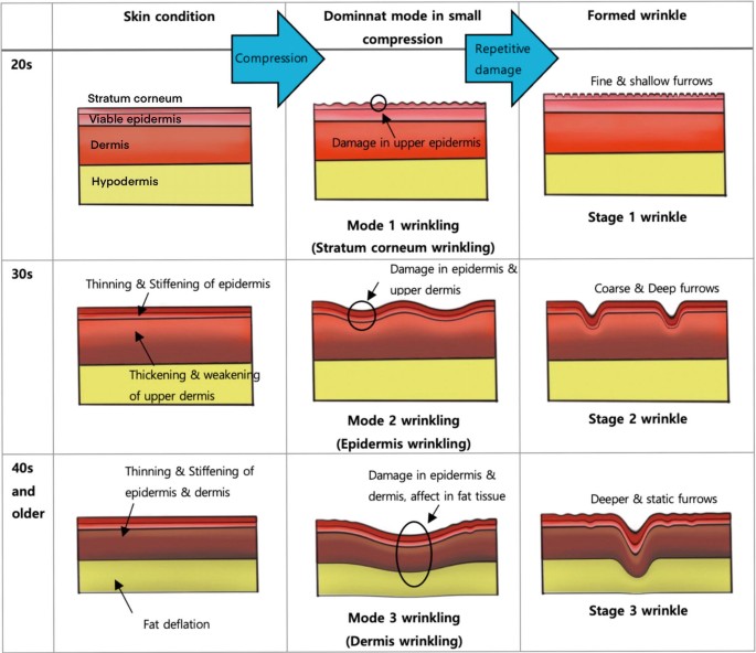Changes in the Face Related to Aging Process | SpringerLink
