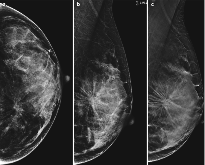 Asymmetries and Architectural Distortion | SpringerLink