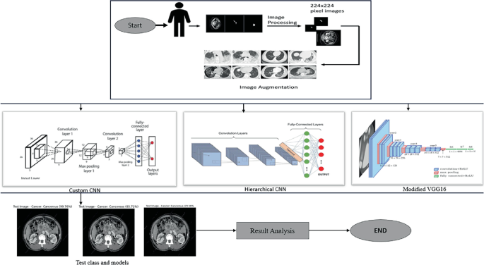 Enhanced Detection of Pancreatic Cancer Using Convolutional Neural ...