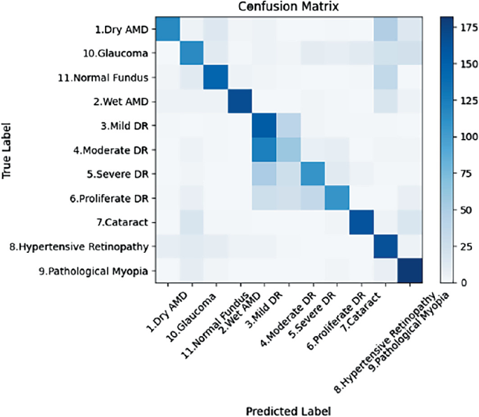Prediction of Retinal Disease Using Deep Learning-Based Blood Vessel ...