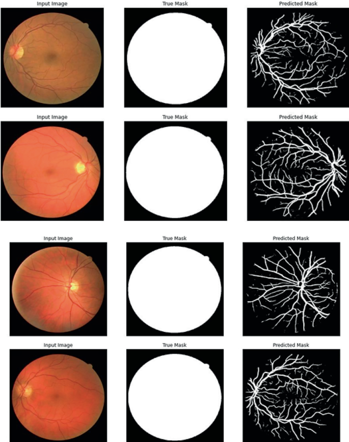 Retinal Vessel Image Segmentation Using U-Net and Channel Attention ...