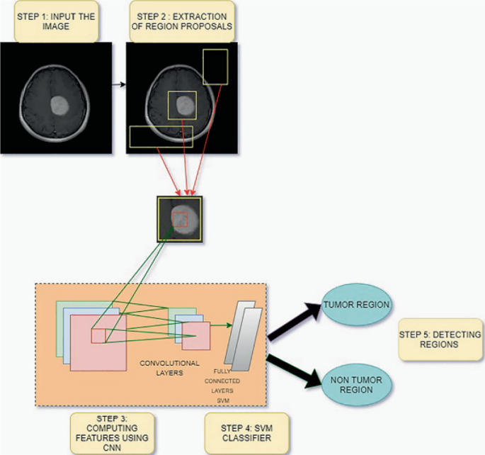 Neuro-Insight: An RCNN Approach for Accurate Brain Tumor Detection in ...