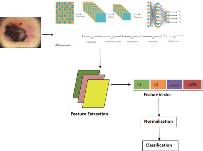 Automated Skin Cancer Diagnosis Using Feature Extraction and Fine ...