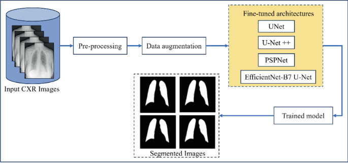EfficientNet-B7 U-Net: A Precise Model for Lung Segmentation in Medical Imaging | SpringerLink