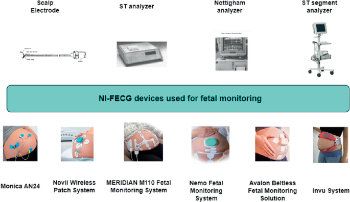 Signal Processing Innovations in Fetal ECG Analysis for Prenatal ...