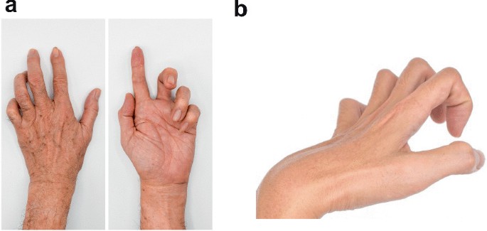 Designing for Empathy: A Case Study on Developing a Wearable Empathy ...