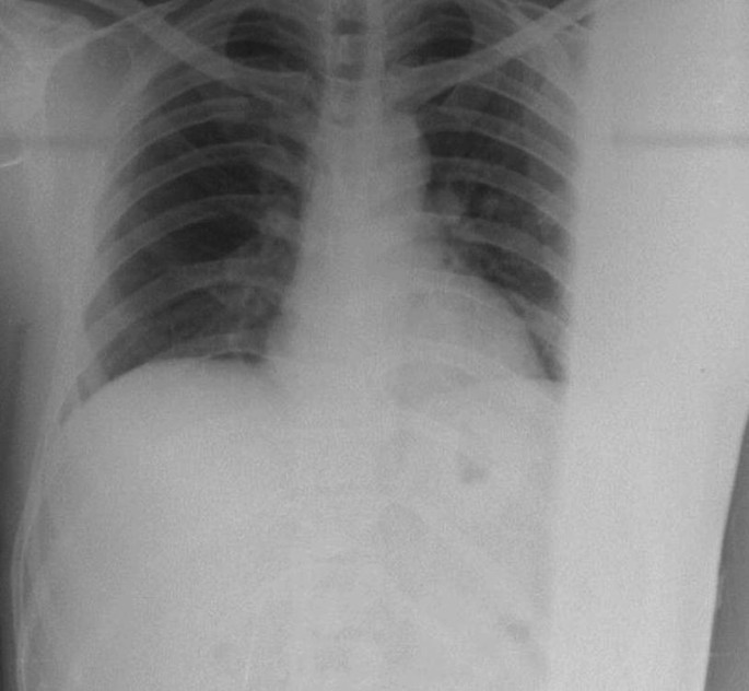 Digital Radiography Systems: Principles of Operation, Clinical ...