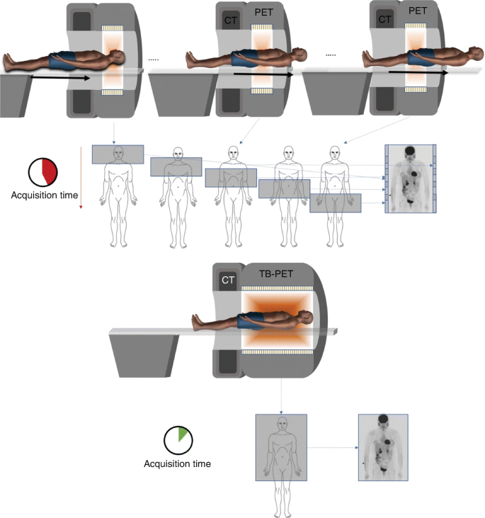Hybrid Imaging: Physics, Principle of Operation, and Quality Control ...