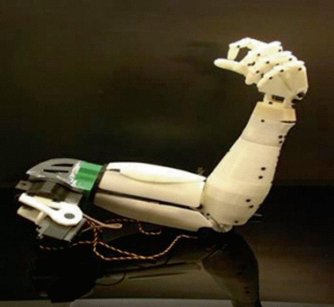 Design and Development of Gesture Controlled Bionic Robot Using Flex ...