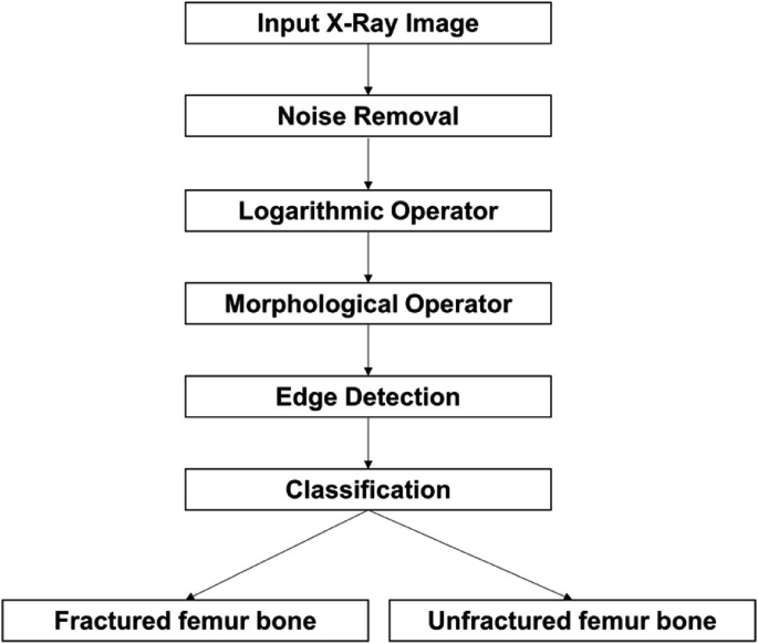 Revolutionizing Bone Fracture Diagnosis Through Deep Learning ...