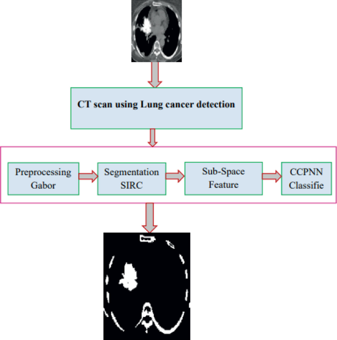 Automated Detection of Lung Cancer Using Deep Learning Models on CT ...