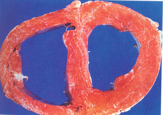 Pathology of the Cardiovascular System | SpringerLink