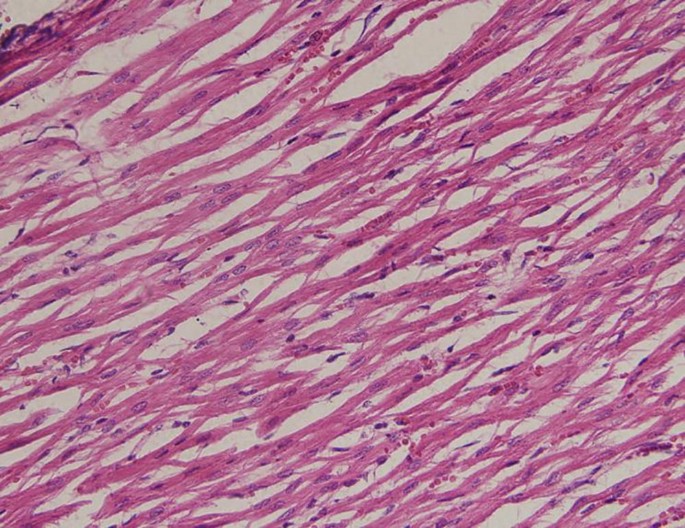 Pathology of the Cardiovascular System | SpringerLink