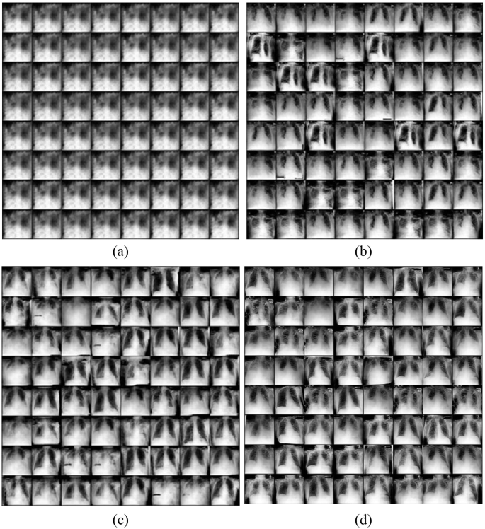 CentroidX-GAN: A Centroid-Based Text-to-Chest X-Ray Image Synthesis ...