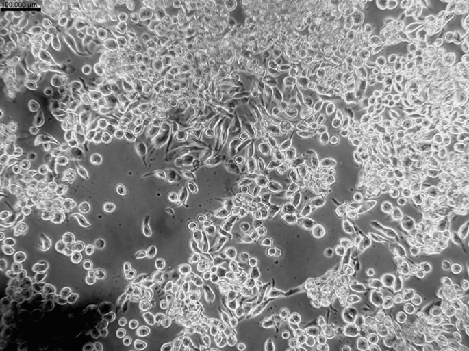 Crustacean Cell Line Development: Status, Constraints, and the Way ...