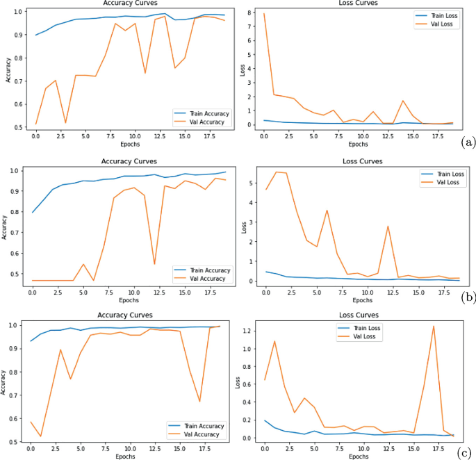 Improving Pneumonia Diagnosis with Integrated Segmentation and ...