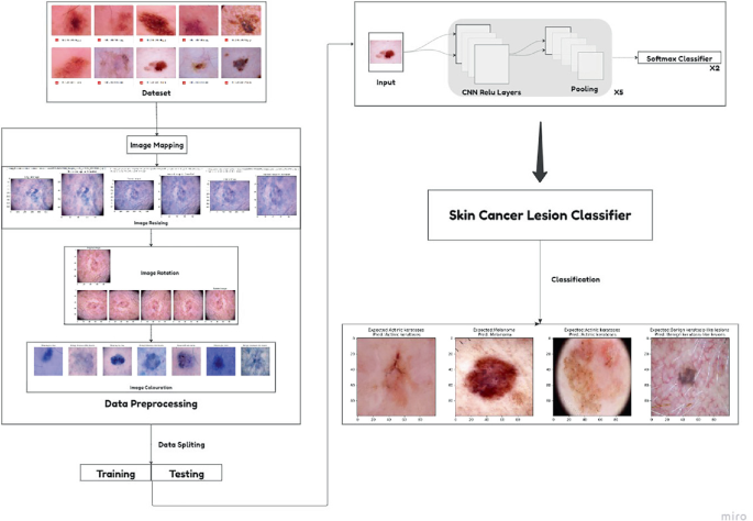 SCP-CNN: Skin Cancer Prediction on Imbalanced Dataset Using CNN Deep ...