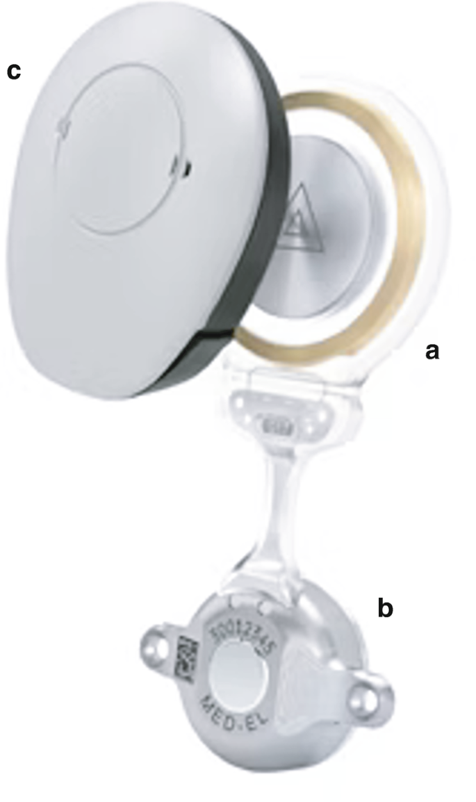 Bone Conduction Implants: Audiological Perspectives | Springer Nature Link