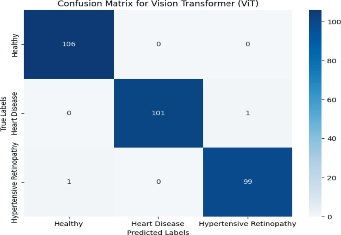 RetinaViTNet: A Vision Transformer-Based Framework for Cardiovascular ...