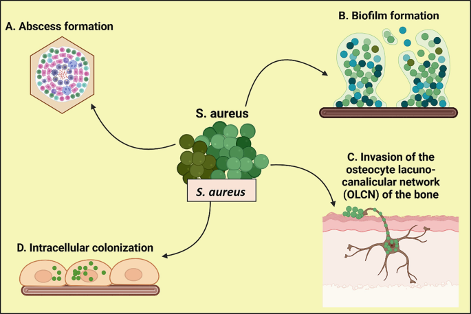 Bone Infections: Associations with Bacterial Biofilm | SpringerLink