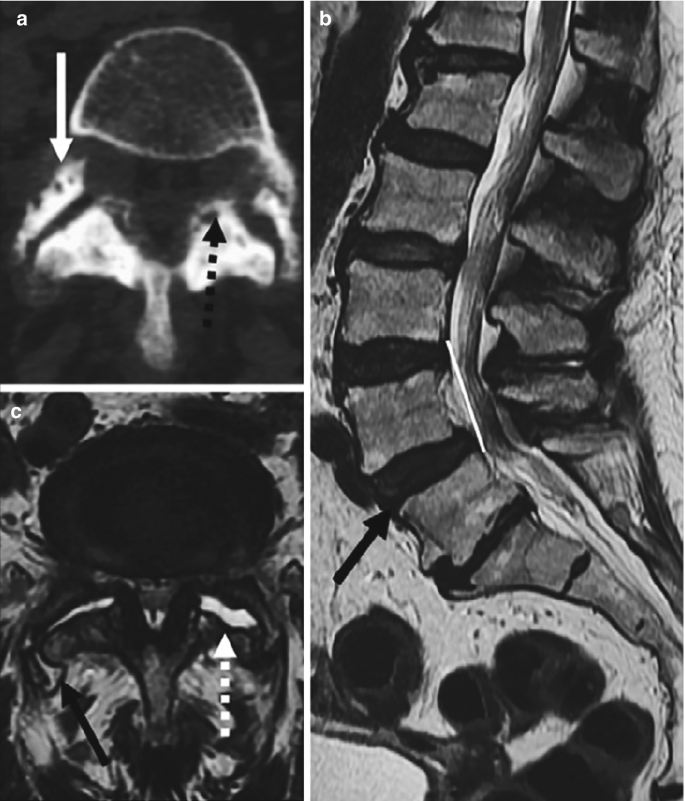 Anatomy of the Spine: Foundation for Understanding Degeneration ...