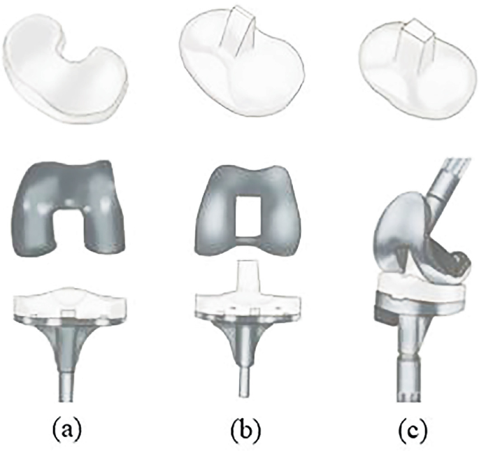 Fundamental Design and Material of Knee Prosthesis | Springer Nature Link