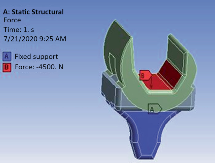 Finite Element Analysis (FEA) on Knee Prosthesis | SpringerLink