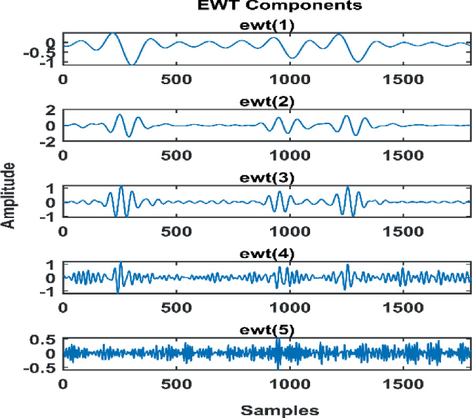 Removal of EOG Artifact Using EWT and SG Filter | Springer Nature Link