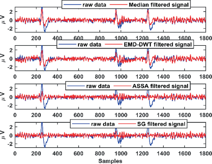 Removal of EOG Artifact Using EWT and SG Filter | Springer Nature Link
