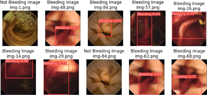 An Integrated Framework for Classifying and Locating Bleeding Areas in ...
