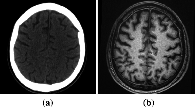 Gray and White Matters Segmentation in Brain CT Images Using Multi-task ...
