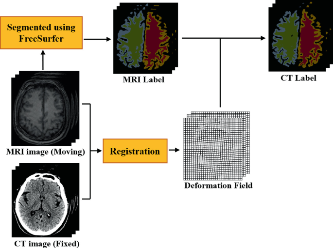 Gray and White Matters Segmentation in Brain CT Images Using Multi-task ...