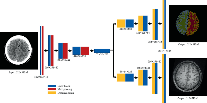 Gray and White Matters Segmentation in Brain CT Images Using Multi-task ...