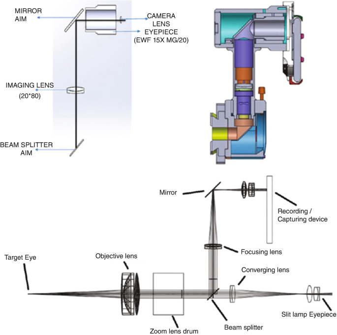 Smartphone-Based Ophthalmic Imaging | SpringerLink