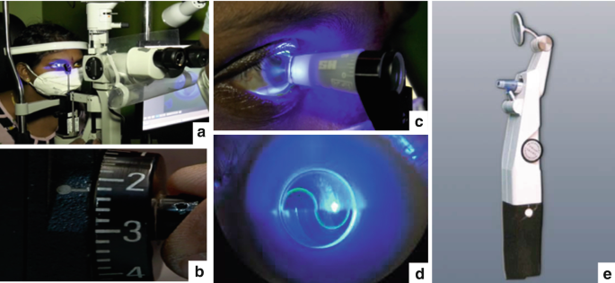 Intraocular Pressure | SpringerLink
