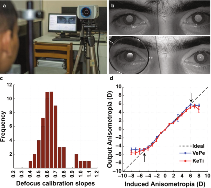 Autorefraction: Objective Estimation of Refractive Error | SpringerLink