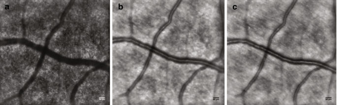 Adaptive Optics | SpringerLink