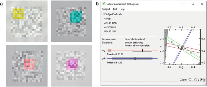 Color Vision | SpringerLink