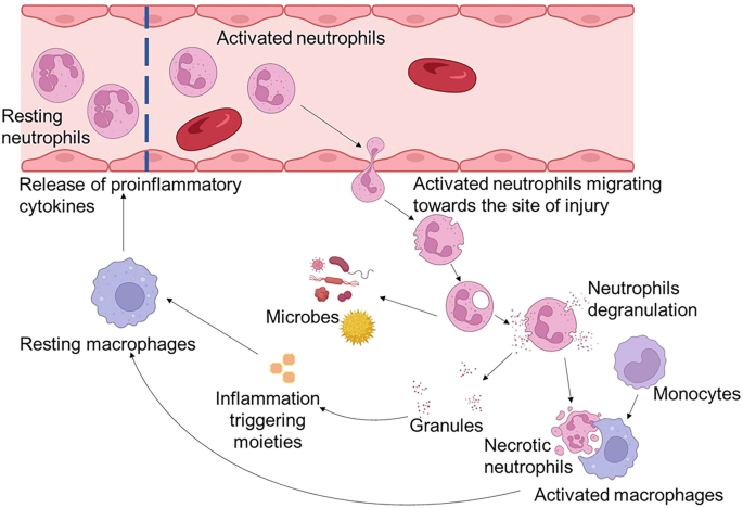 Overview of Inflammation | SpringerLink